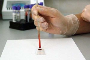 Testosterone Blood Test Results Explained, Understand Test Result